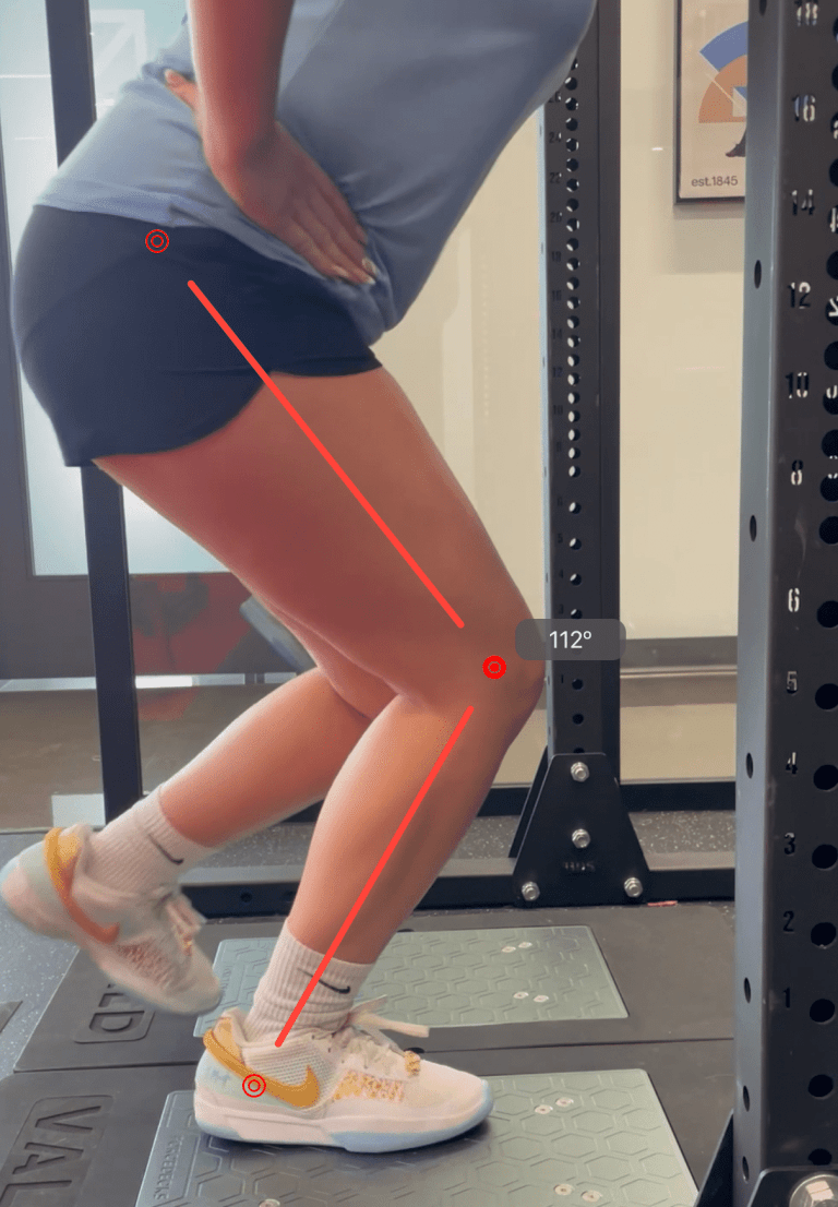 Hop Tests & ACL Return to Sport | Calgary Physiotherapy